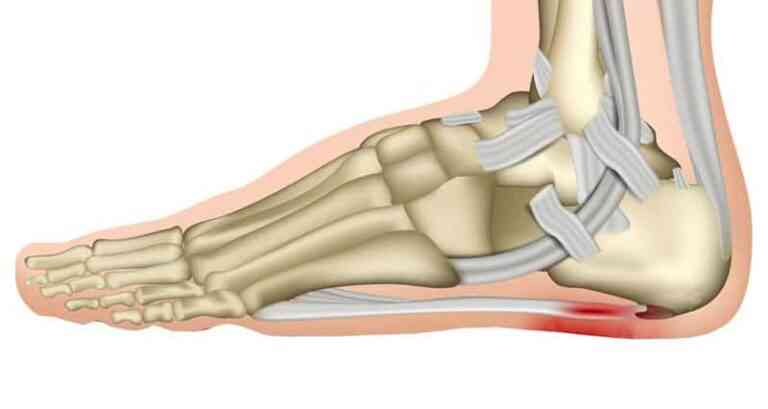 Avoid These Mistakes If You Have Degenerative Disc Disease